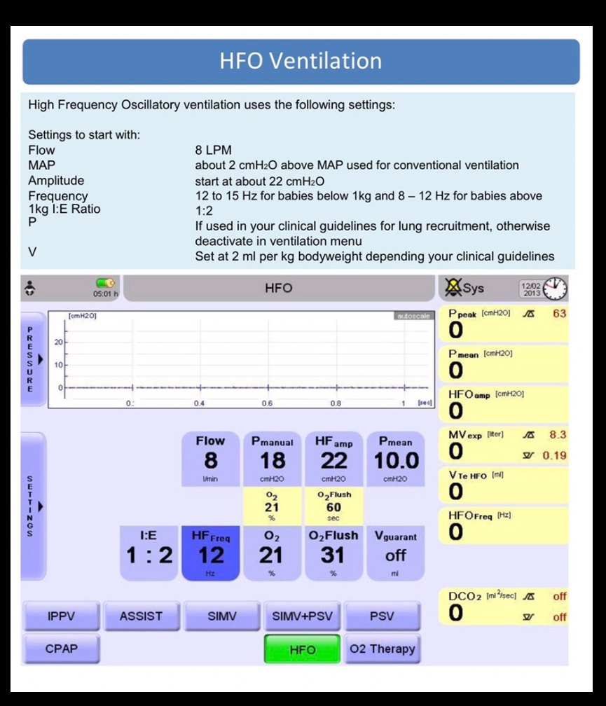 고빈도 환기 (HFV) - Welcome GGumi World